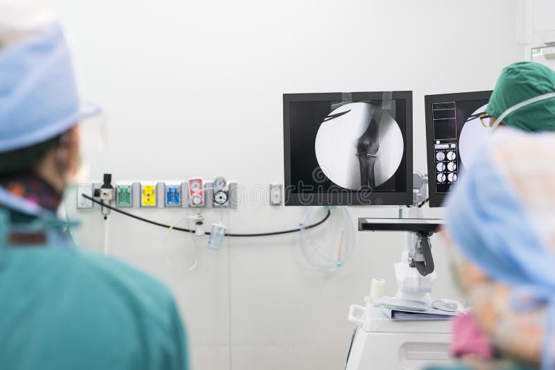 Endovascular intervention stock photo. Image of patient - 65492360