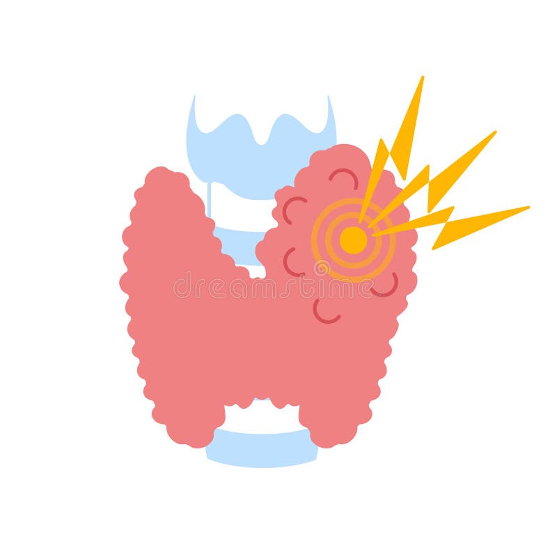 Thyroid Gland with Goiter Body Organ Icon Stock Vector - Illustration ...