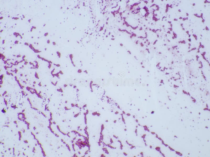 Enterococcus Faecalisi stock photo. Image of bacteria - 351329370