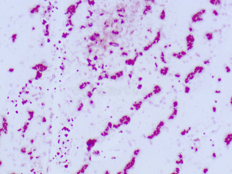 Enterococcus Faecalisi stock image. Image of faecalisi - 351329565