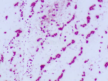 Enterococcus Faecalisi stock image. Image of faecalisi - 351329565