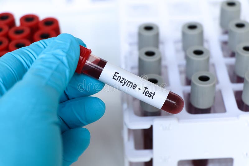 Enzyme Test, Blood Sample To Analyze in the Laboratory Stock Photo ...