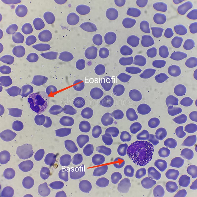 Eosinofil and basofil stock image. Image of basofil - 262902387