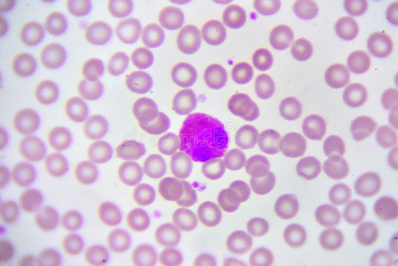 Eosinophil Under Microscope