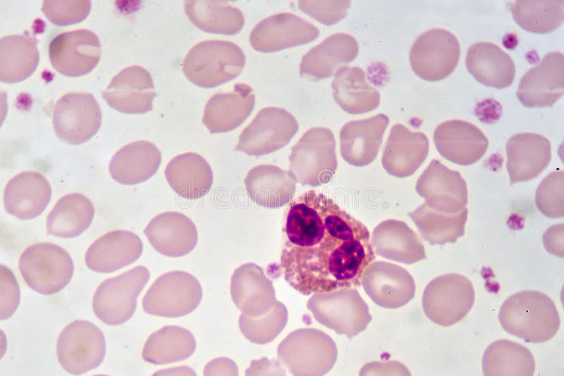 Eosinophil cell stock image. Image of basophil, eosinophil - 101184465