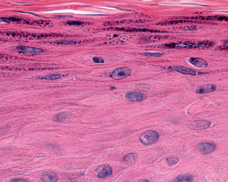 Epidermis. Spinous and Granular Layers Stock Image - Image of ...