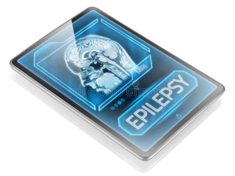 Epilepsy examination stock photo. Image of sensor, medicine - 5359920