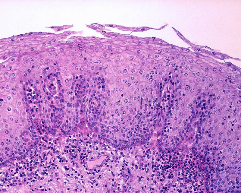 Epitelio dell'esofago immagine stock. Immagine di microscopia - 117240105