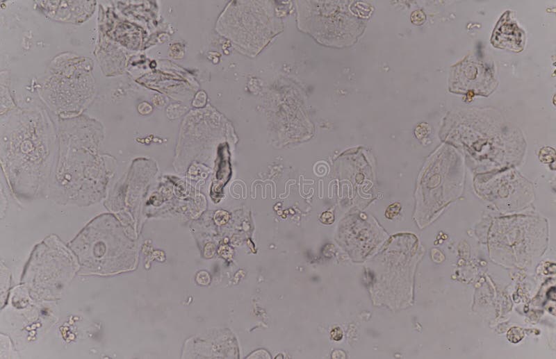 Epitheliaal Weefsel Met De Gistcellen Van Bacteriëncellen Stock ...