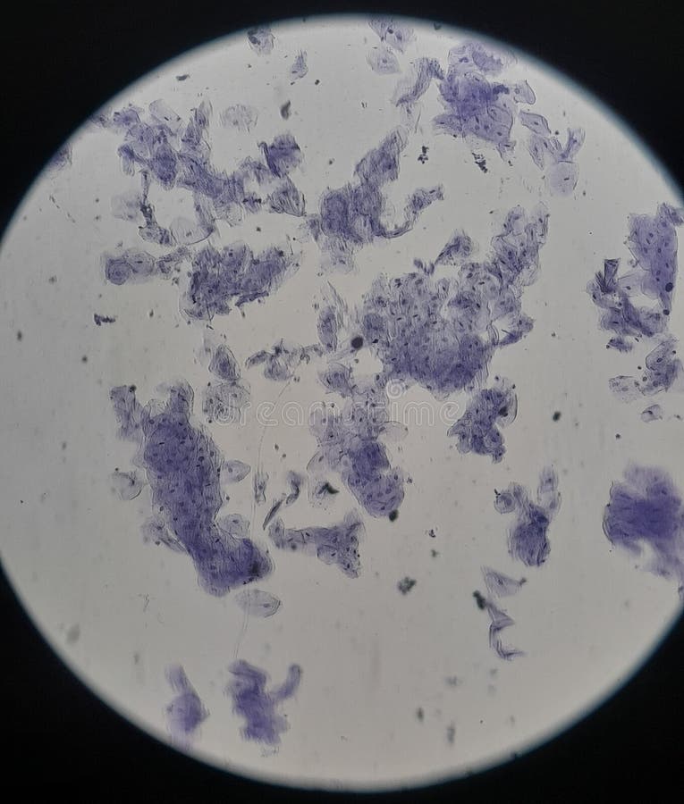 Epithelial Cells of Human Oral Cavity Under the Microscope Stock Photo ...