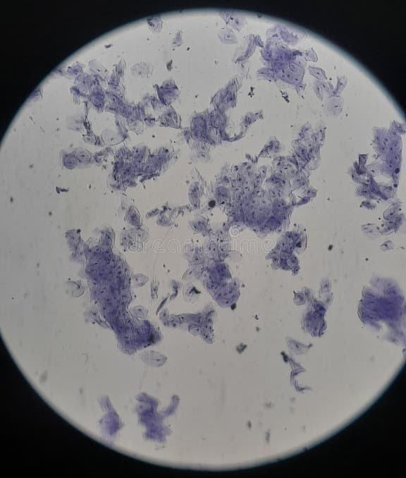 Epithelial Cells of Human Oral Cavity Under the Microscope Stock Photo ...