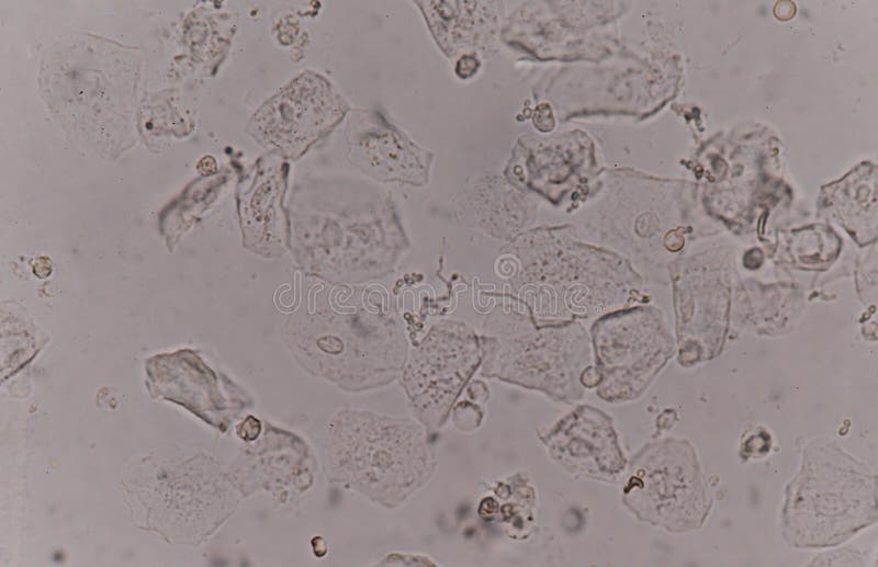 Yeast Cells Under Microscope 40x