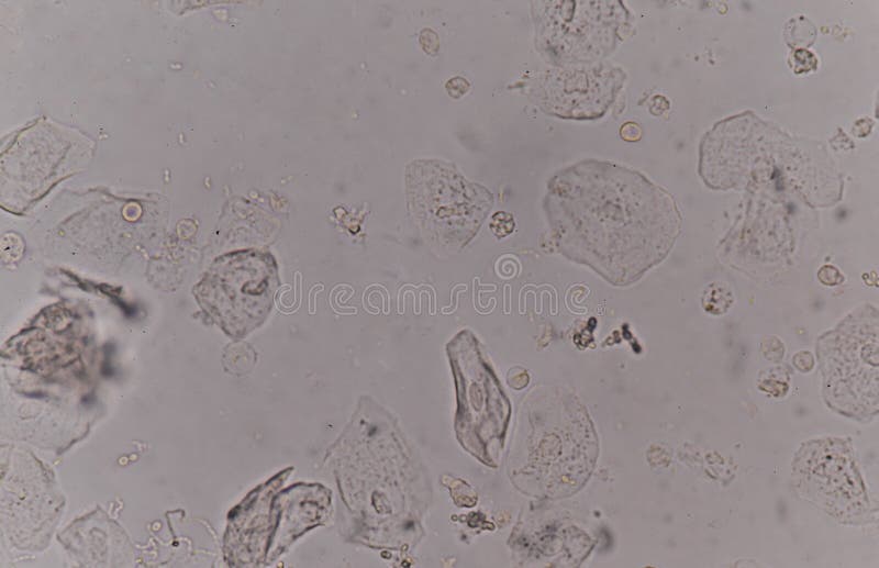 Yeast Under Microscope Labeled Yeast Cells Under The Microscope