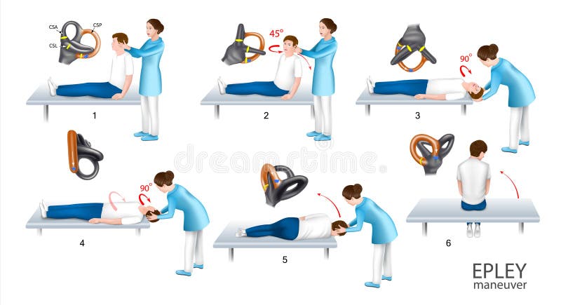 Epley Maneuver is Performed Help of a Doctor Stock Vector ...