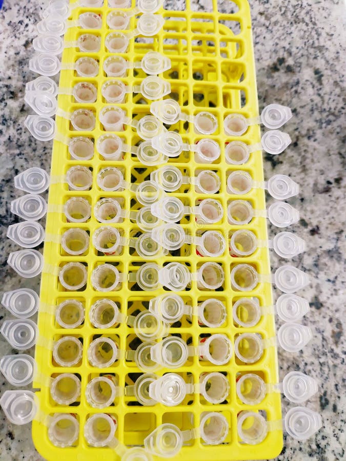 Eppendorf in Rack for Laboratory Examinations Stock Image - Image of ...