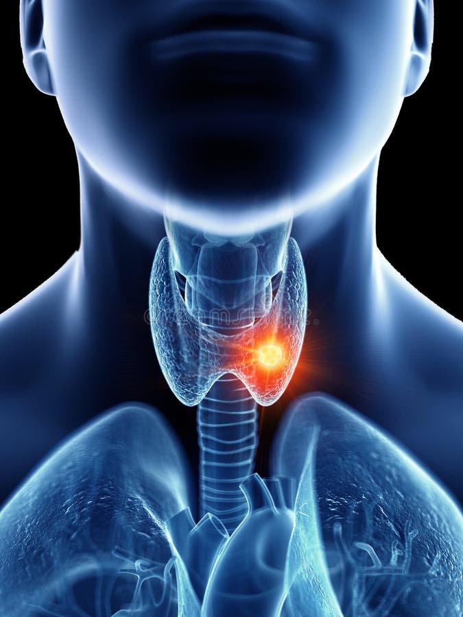 Anatomia da garganta ilustração stock. Ilustração de anatomia - 169376118