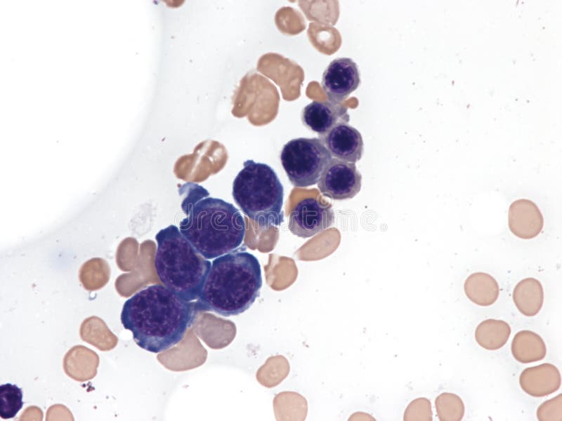 Normal Erythroblasts in the Bone Marrow Stock Photo - Image of ...