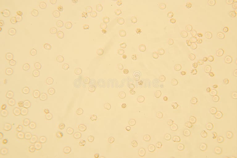 Erythrocytic Cells and Inclusions Stock Photo - Image of inclusions ...