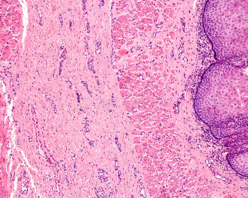 Esófago Mucosas De Muscularis Foto de archivo - Imagen de tripa, tejido ...