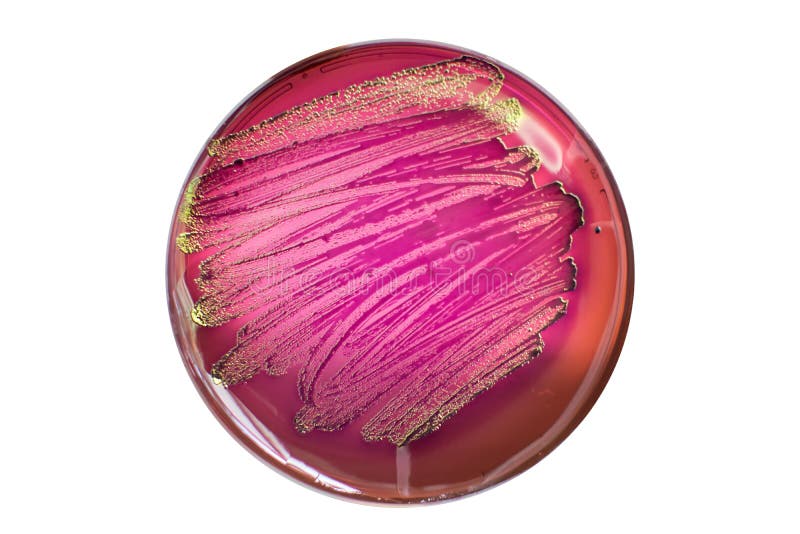 Escherichia Coli Bacterial Colonies on MacConkey Agar Media Stock Image ...