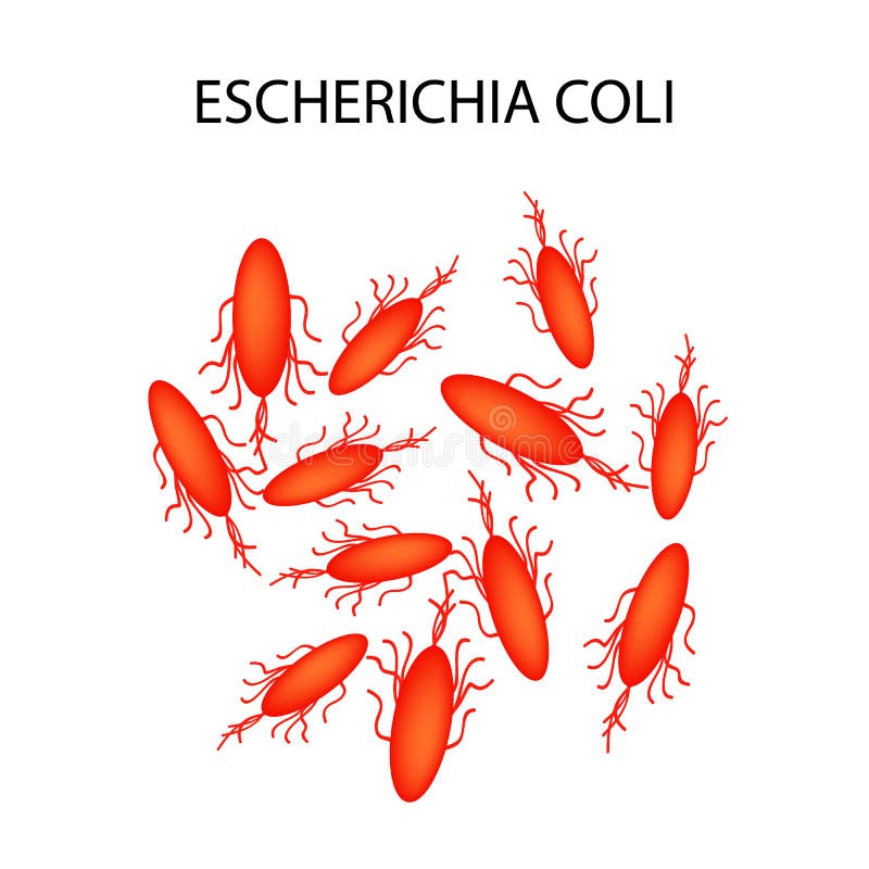 Escherichia Coli. Infographics. Vector Illustration on Isolated ...