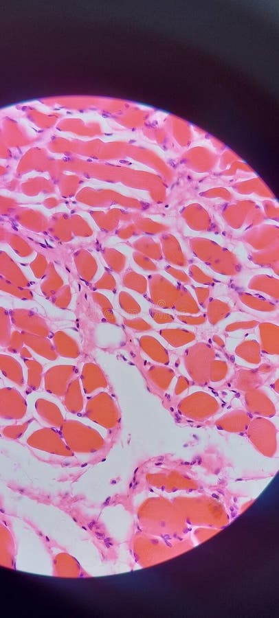 Esophagus Under Microscope Histology Class Stock Photo - Image of ...