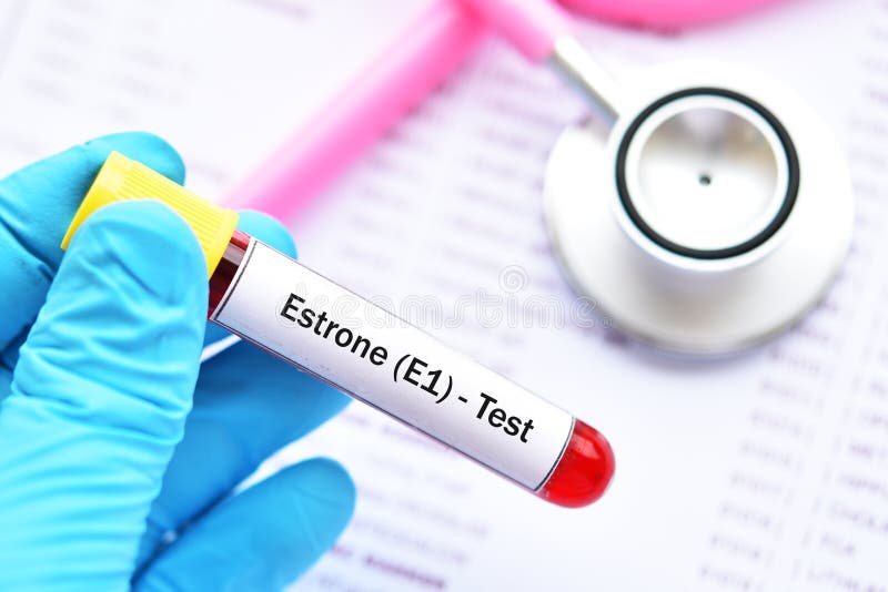 Essai d'hormone d'oestrone photo stock. Image du sexualité - 131672222