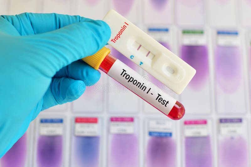 Test de la Troponine I photo stock. Image du chimie, cardiaque - 80025924