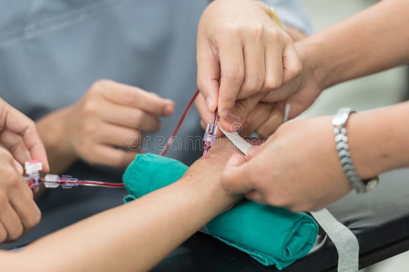 Línea arterial imagen de archivo. Imagen de sangre, anestesia - 56161057