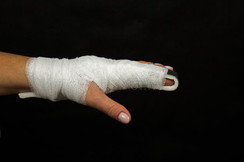 6,466 Dedo Quebrado Fotos - Fotos de Stock Gratuitas e Fotos Royalty ...