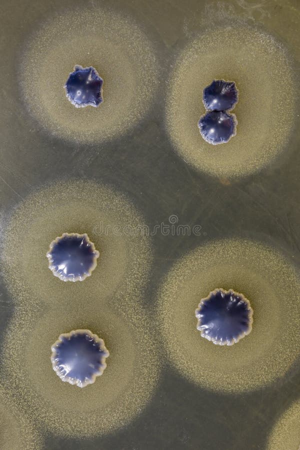 Estafilococo aureus foto de archivo. Imagen de blanco - 175905744