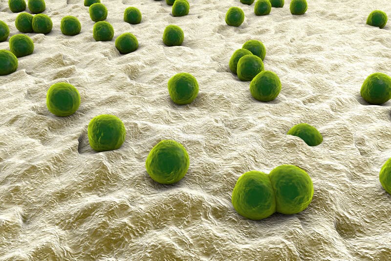 Estafilococos En La Superficie De La Piel Stock de ilustración ...