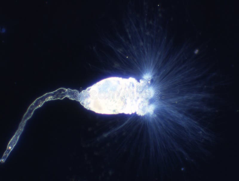 Ciliates Dans Les Gouttes D'eau Image stock - Image du microscope ...