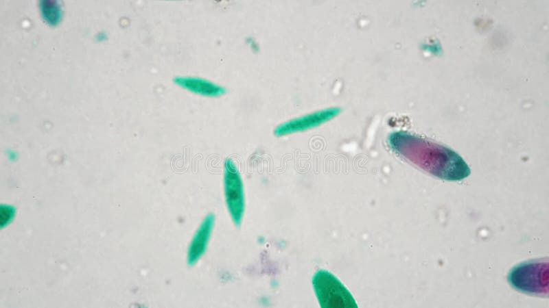 Euglena Under Microscope 40x
