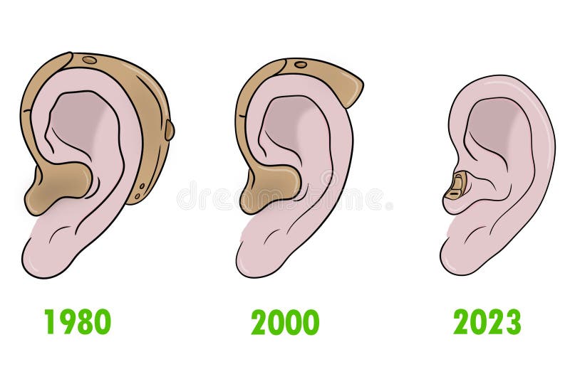 Evolution of Cochlear Implant through the Years. from Big To Small ...