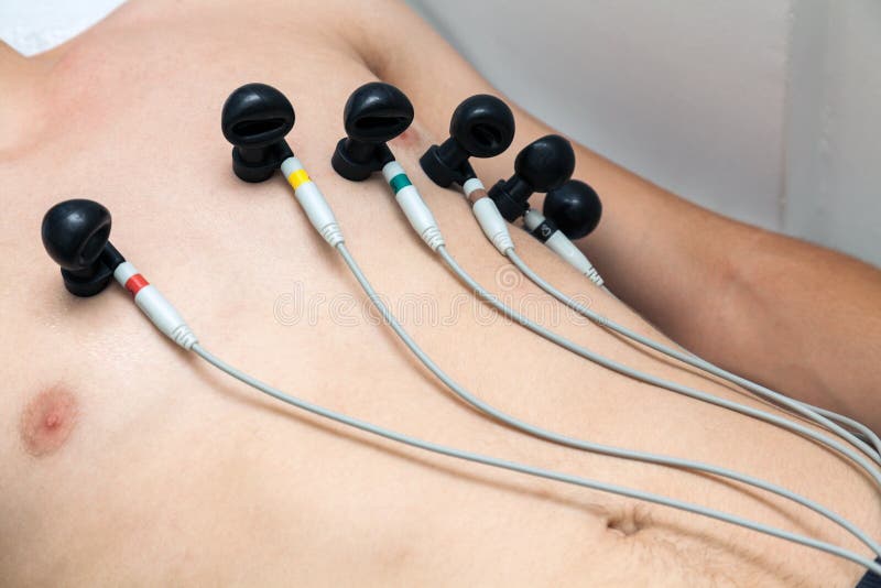 Examen cardiaque photo stock. Image du clinique, examen - 35871234