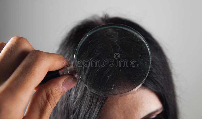 Examina El Pelo De Una Joven Con Una Lupa Imagen de archivo - Imagen de ...