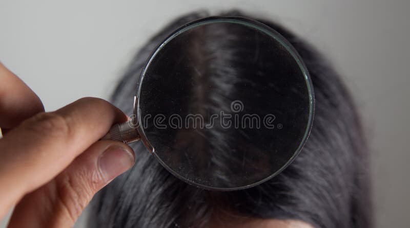 Examina El Pelo De Una Joven Con Una Lupa Foto de archivo - Imagen de ...