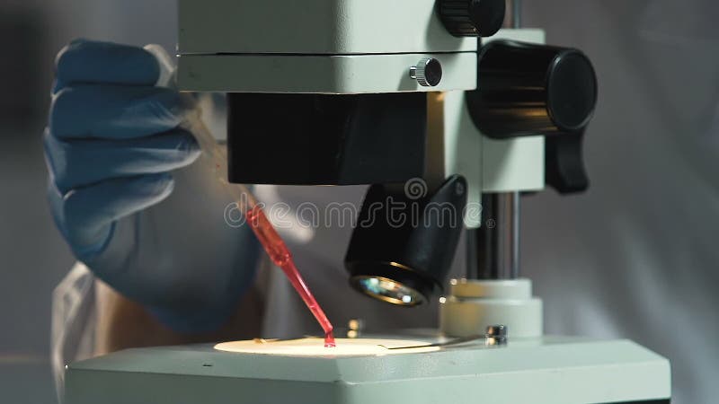 Examination of Blood Drop Under Microscope, Analysis for Viruses, AIDS ...
