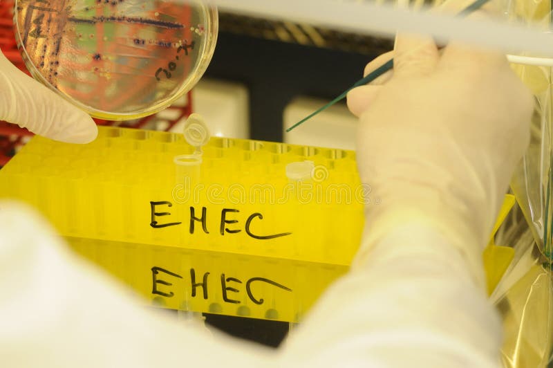Examination for EHEC Pathogens in a Laboratory Stock Image - Image of ...