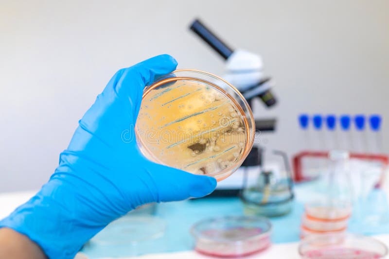 Examine Bacteria in Petri Dishes in the Laboratory. Selective Focus ...