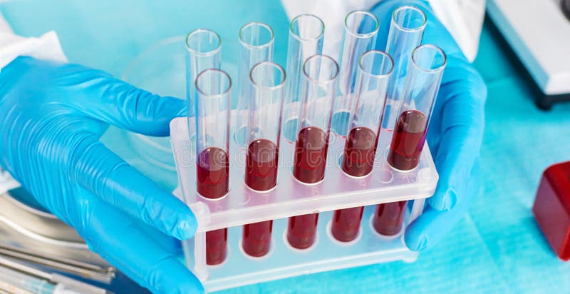 Examine Blood in the Laboratory. Selective Focus Stock Image - Image of ...