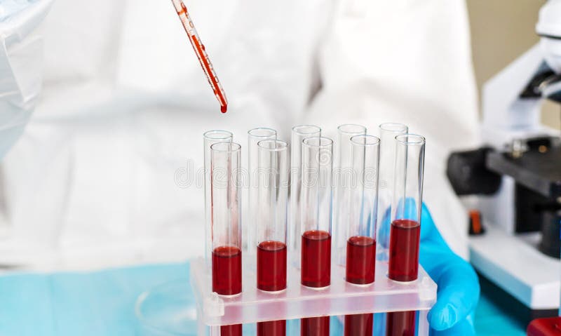 Examine Blood in the Laboratory. Selective Focus Stock Image - Image of ...