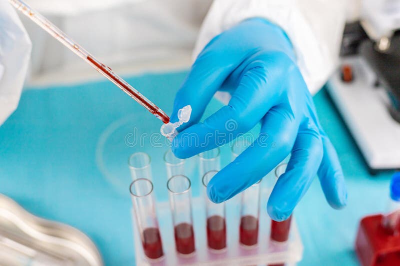 Examine Blood in the Laboratory. Selective Focus Stock Photo - Image of ...