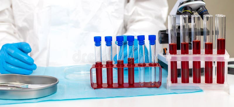 Examine Blood in the Laboratory. Selective Focus Stock Image - Image of ...
