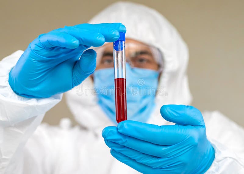 Examine Blood in the Laboratory. Selective Focus Stock Image - Image of ...