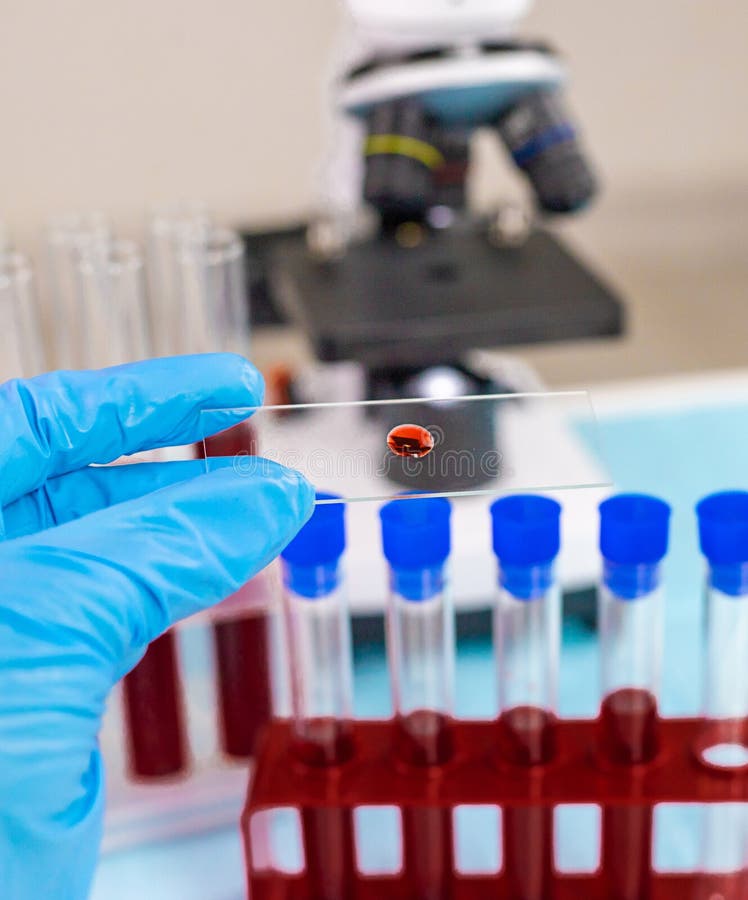 Examine Blood in the Laboratory. Selective Focus Stock Image - Image of ...