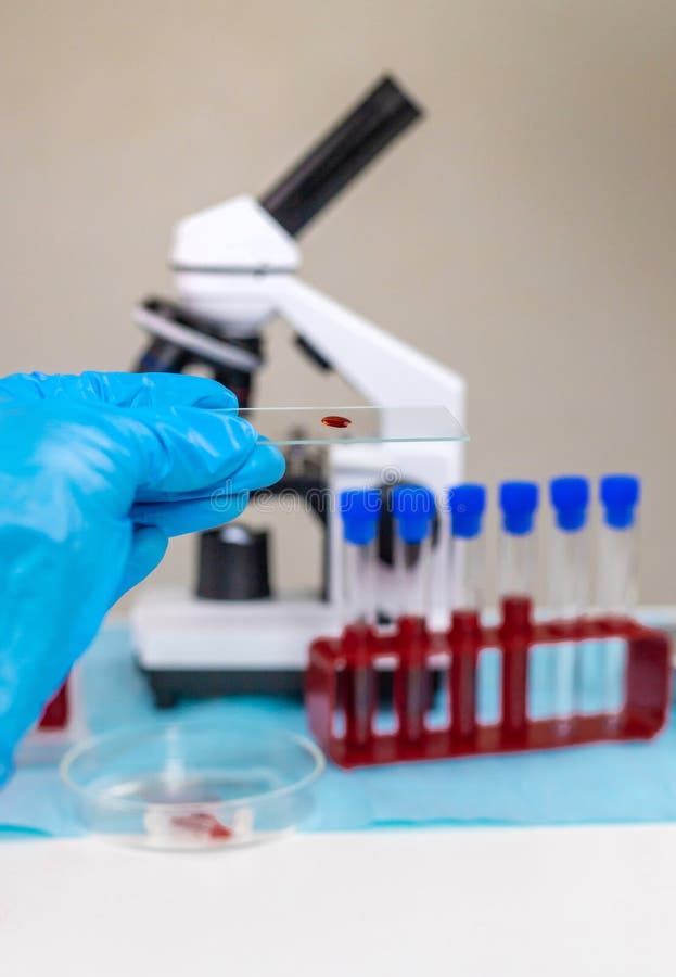 Examine Blood in the Laboratory. Selective Focus Stock Photo - Image of ...