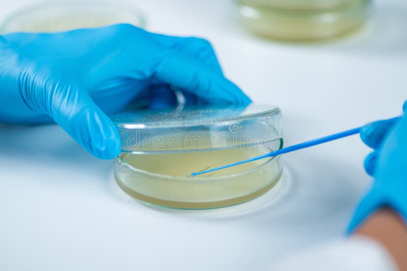Examining Bacterial Culture Plates in a Microbiology Lab Stock Image ...