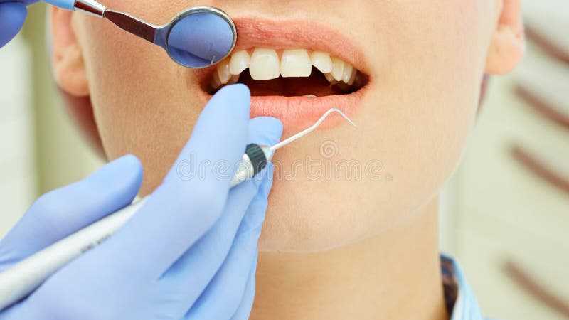 Examining teeth stock image. Image of doctor, female - 60026995